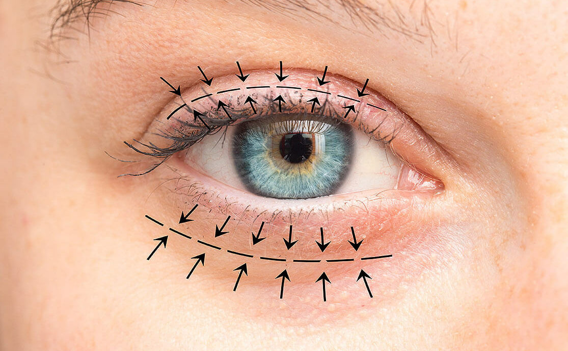 Oculoplastic Services - Heathrow Surgery Center